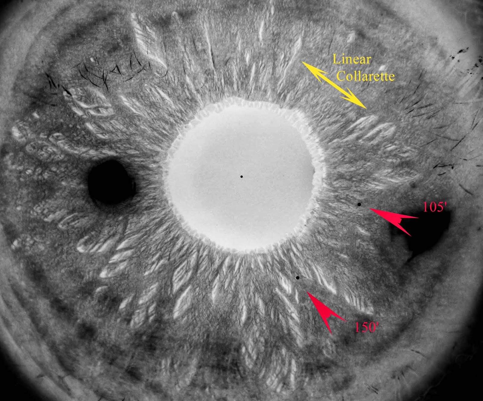 Modern & Multidimensional Iridology: The Inner Pupillary Border ...