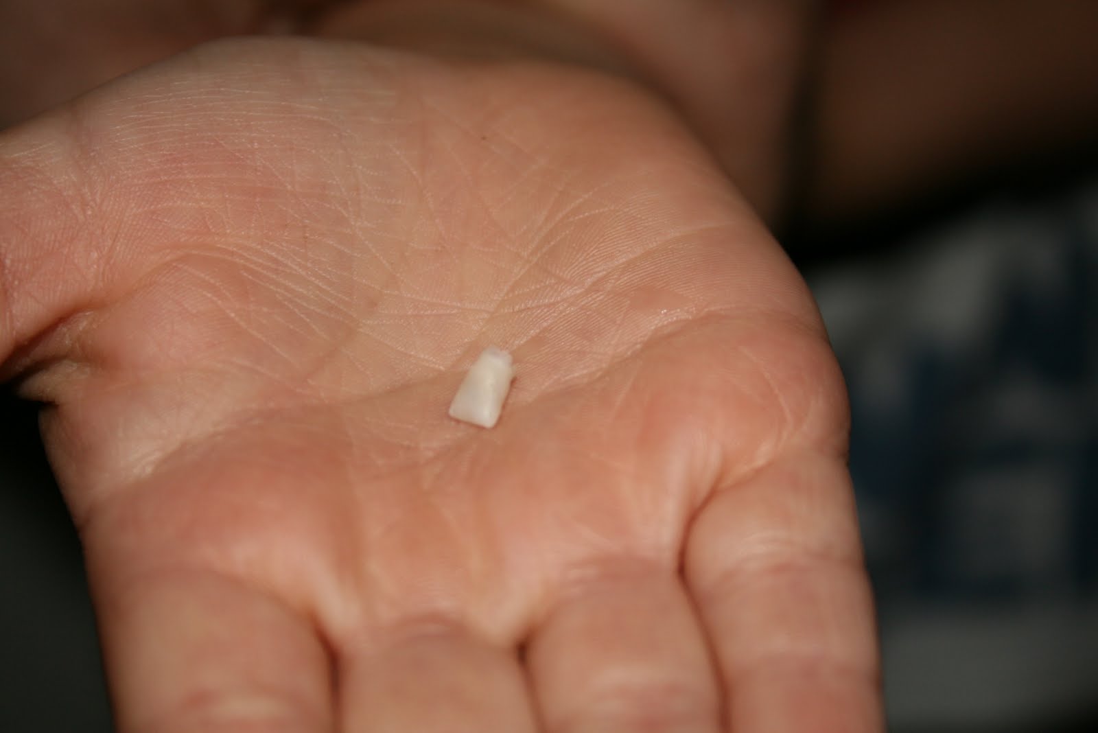 Hverdagsliv: 11 uker - gravid med forbehold