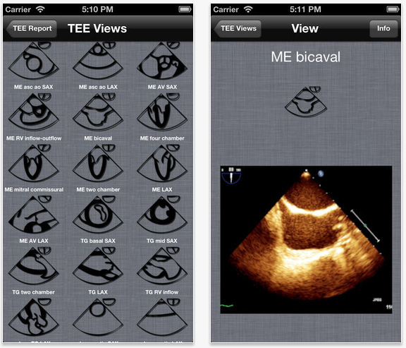 Cardiovascular Anesthesia and Critical Care: TEE Report (Apple App)