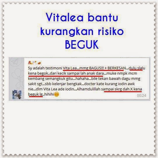 PENGEDAR SHAKLEE BANTING: KEKURANGAN IODIN PUNCA BEGUK