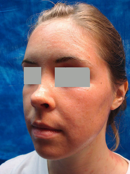 VIRTUAL GRAND ROUNDS IN DERMATOLOGY 2.0: Deadline Looming