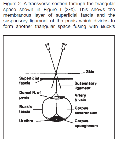 Study Notes: WRIST , DIGITAL , PENILE , FACIAL BLOCK