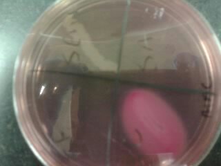 Microbiology EJournal: Day 16-Started PEA,CNA,Mannitol Salt,MacConkley ...