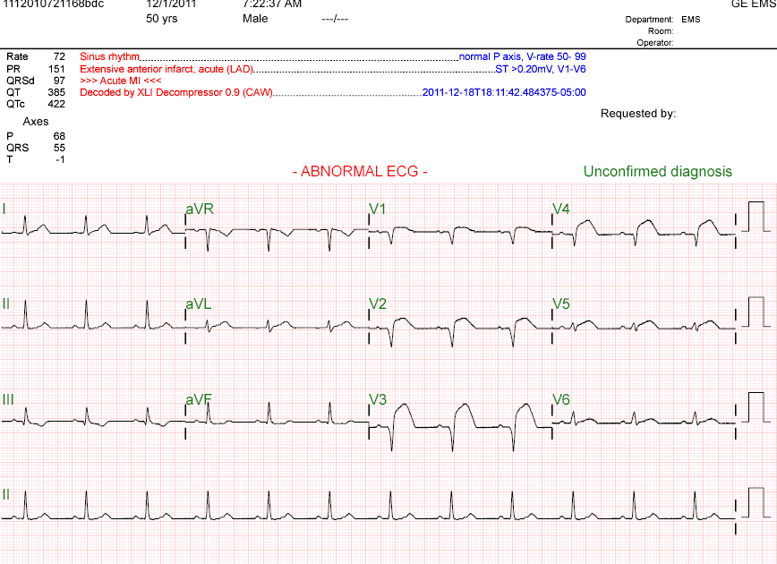 My Variables Only Have 6 Letters: Philips Healthcare's Sierra ECG ...