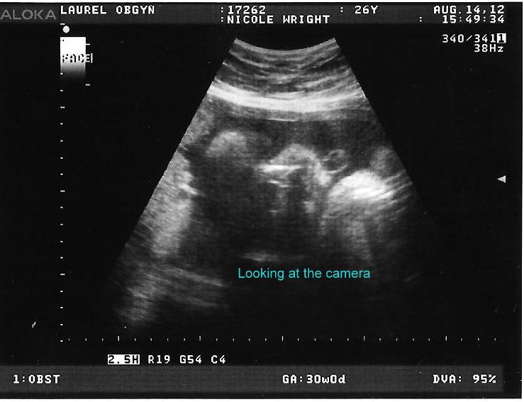 For this child I have prayed: 30 week Growth Scan and appt