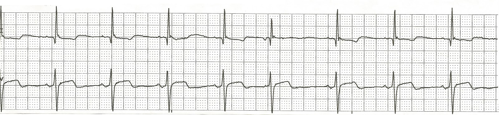 ECG Rhythm Strips 80