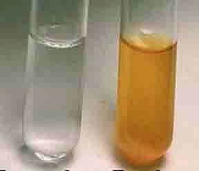 TRANSUDAT DAN EKSUDAT | Dunia Analis Kesehatan Indonesia