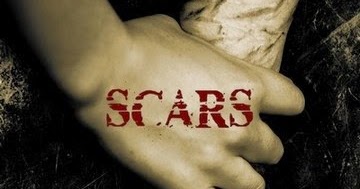 The Truth Media Blog: No Scar