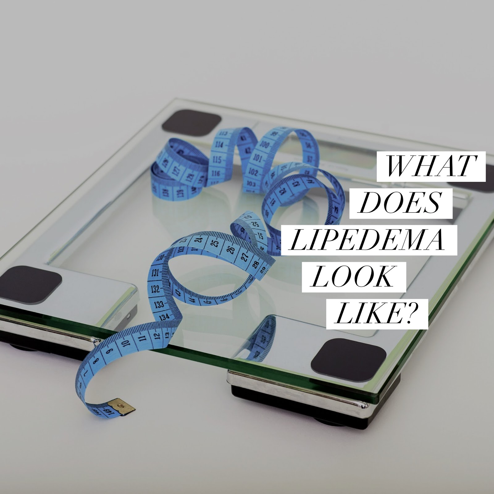 Lipedema Treatment Guide: Signs and Symptoms of Lipedema for the ...