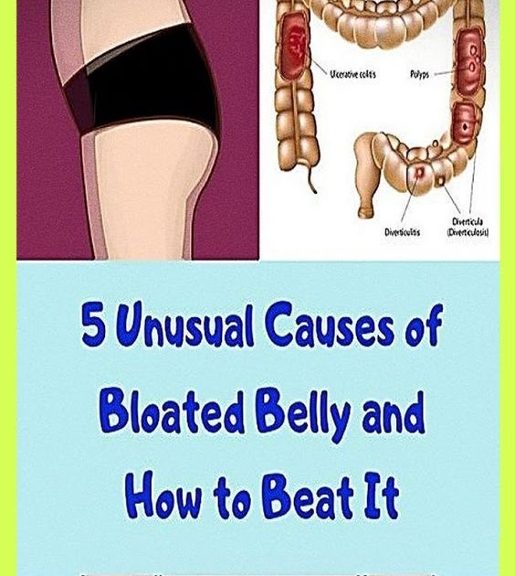5 Unusual Causes of Bloated Belly and How to Beat It - wellness topic