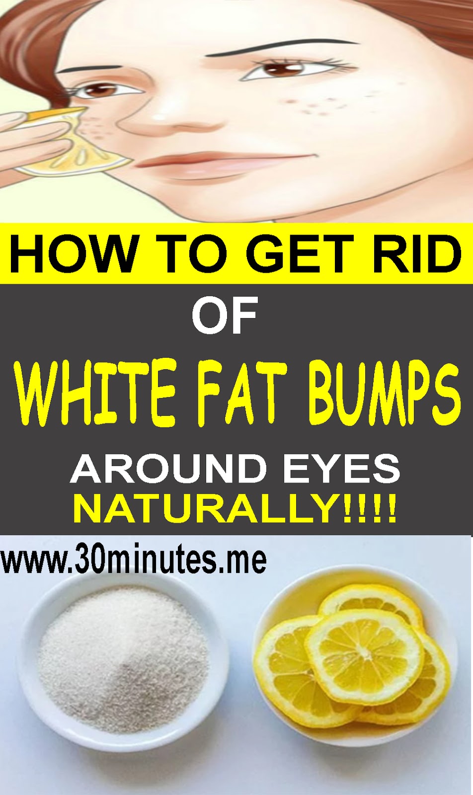 How To Get Rid Of White Fat Bumps Around Eyes Naturally HEALTH And how-to-get-rid-of-white-fat-bumps-around-eyes-naturally-health-and