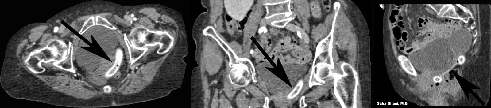 Roentgen Ray Reader: January 2013