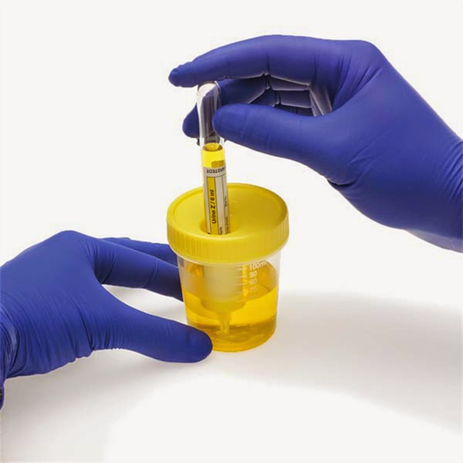 L'ECBU | Récap' IDE