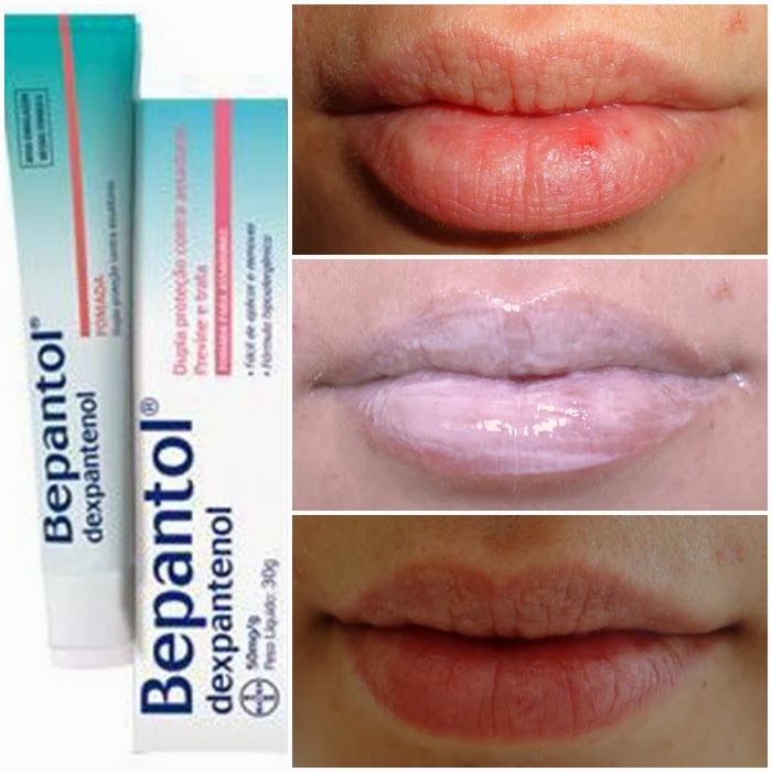 Diva* sem limite: Lábios ressecados