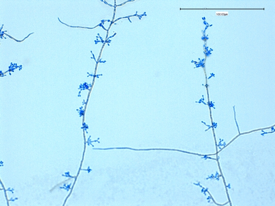 Fun With Microbiology (What's Buggin' You?): Fonsecaea pedrosoi/monophora