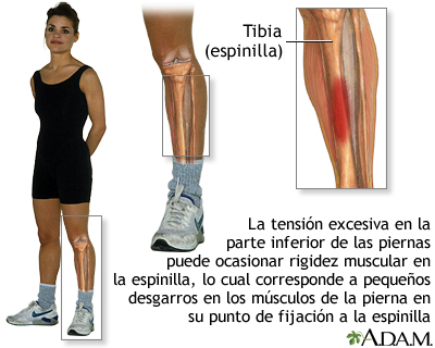 Lesiones Deportivas: Lesiones Frecuentes