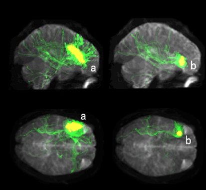 MIND: Neuro-cognitive aspects of mystical experience