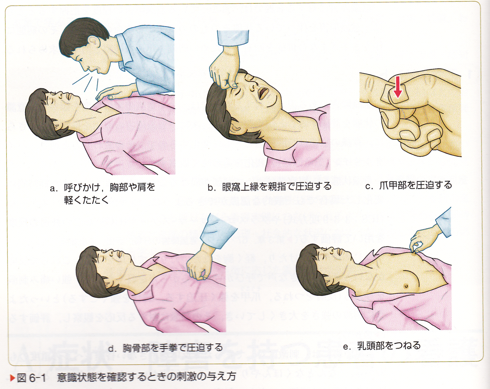 ☆看護学生講座のブログ☆Nursing student: 194 意識状態 ｢グラスゴーコーマスケール(GCS)のポイント｣
