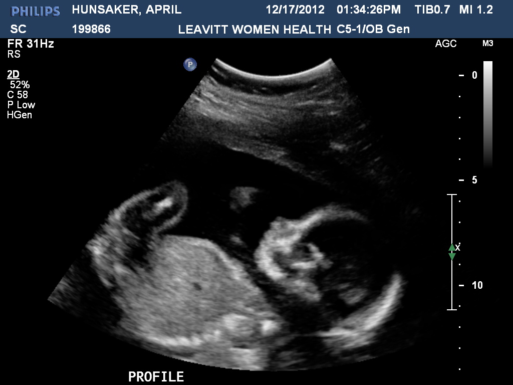 Hunsaker Zoooooo: 21 Week Ultrasound