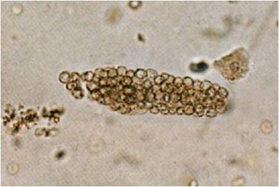 EGO (MICROSCOPICO): EXAMEN GENERAL DE ORINA MICROSCOPICO