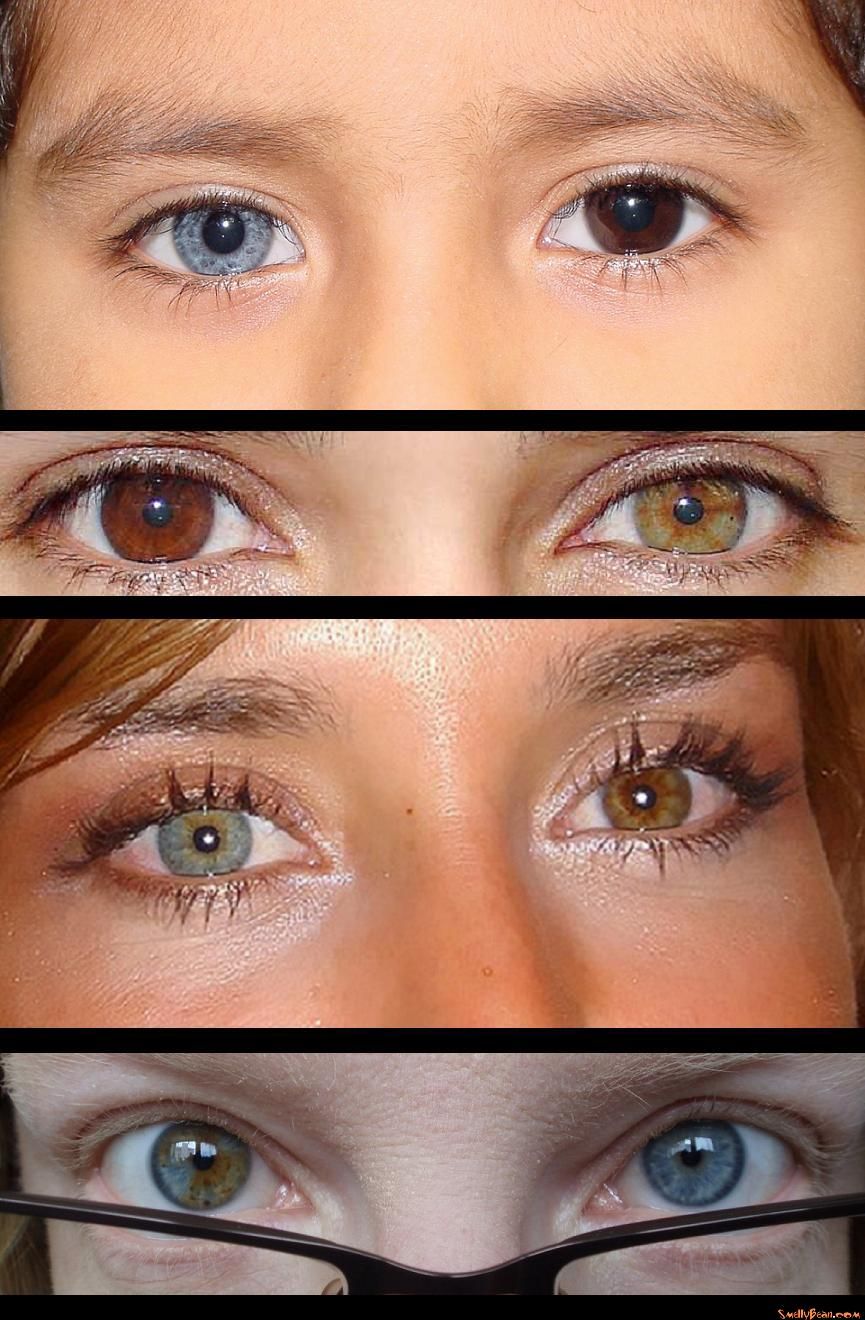 Beverly Hills Optometry (Dr Kambiz Silani): National Different Colored ...