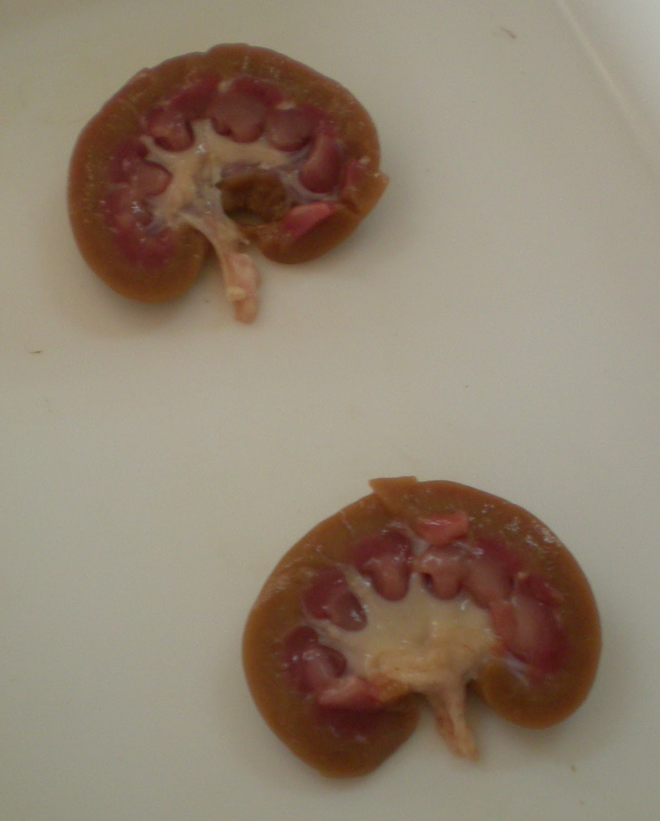 EL CUERPO HUMANO: Disección de un riñón