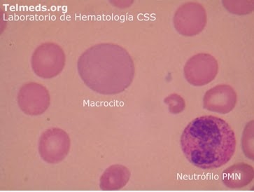 HEMATOLOGÍA: Serie Roja