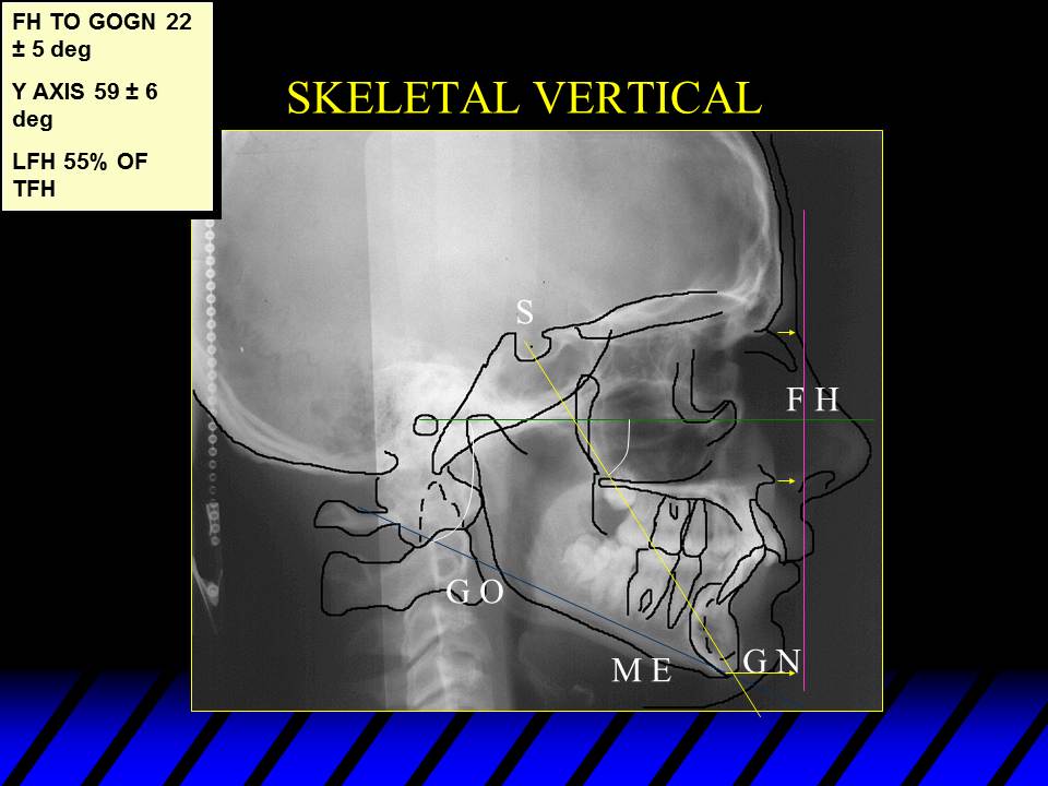 Dentistry: CEPHALOMETRIC ANALYSIS