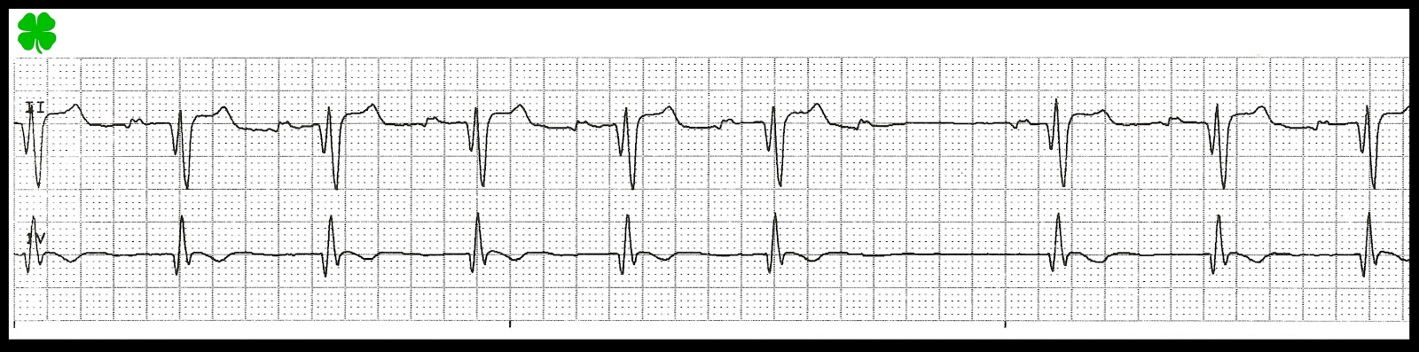 Practice EKG strips
