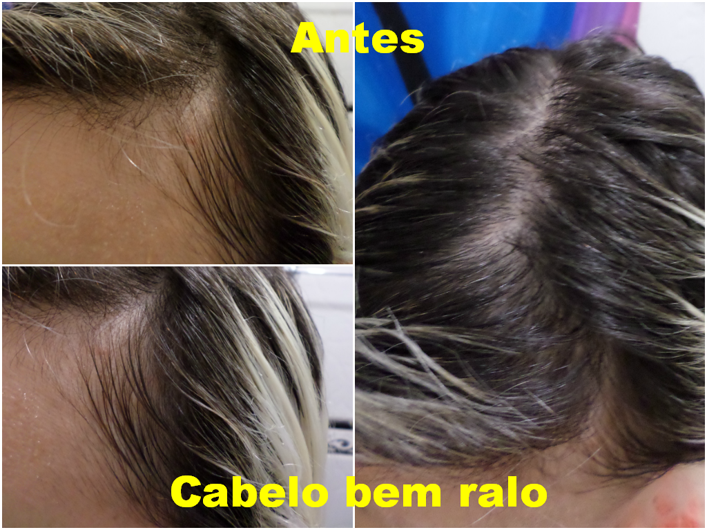 QUAL É O SEU MUNDO?: Imecap hair funciona? Antes e depois.