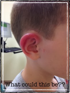 I Cannot Be the Only One: A Bug Bite or An Allergic Reaction? What is it?!