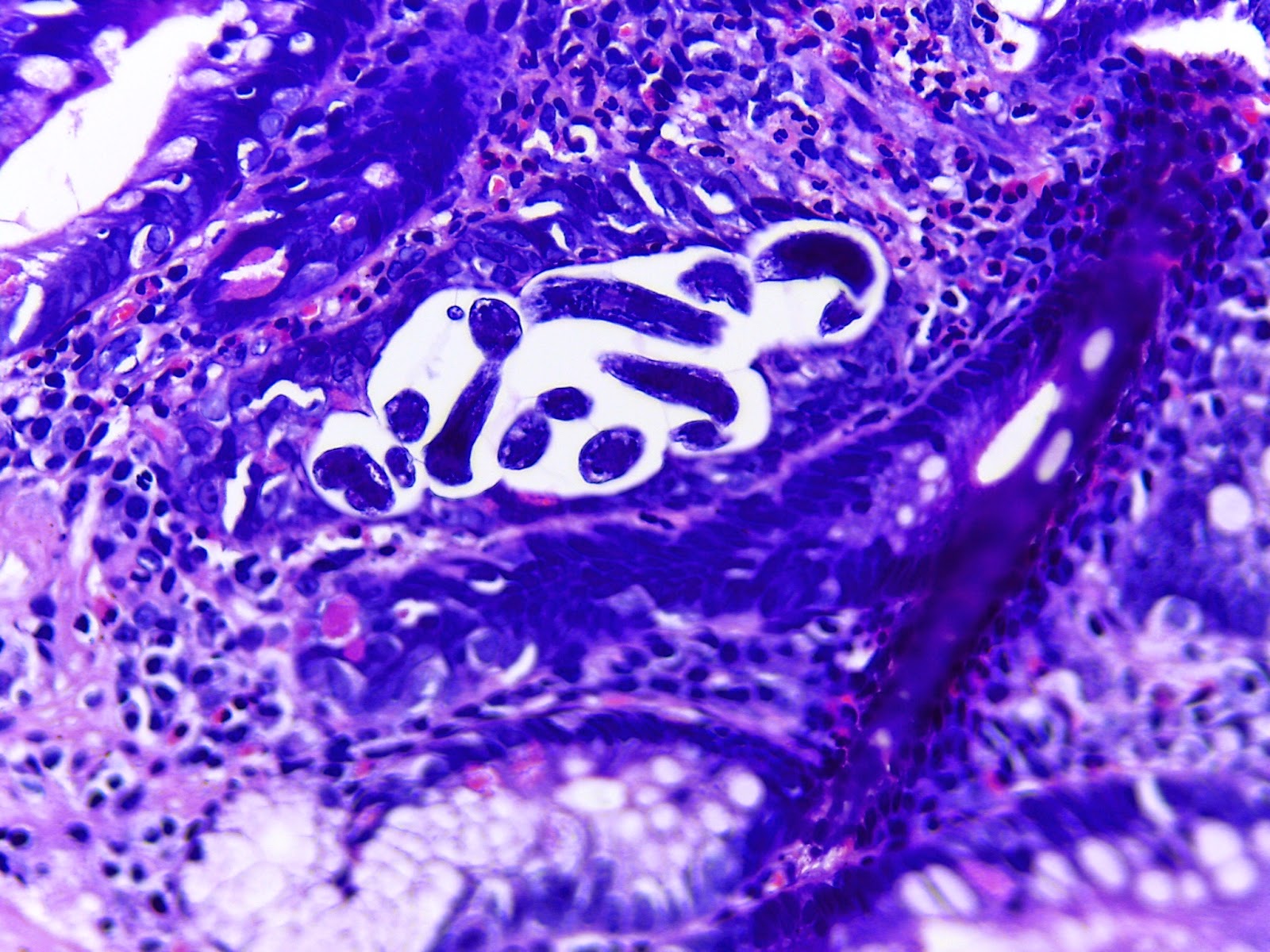 GASTROINTESTINAL AND LIVER HISTOLOGY PATHOLOGY ATLAS: DUODENUM ...