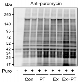 Panaxatriol - Ginseng Constituent Has Protein-Anabolic Effects When It ...