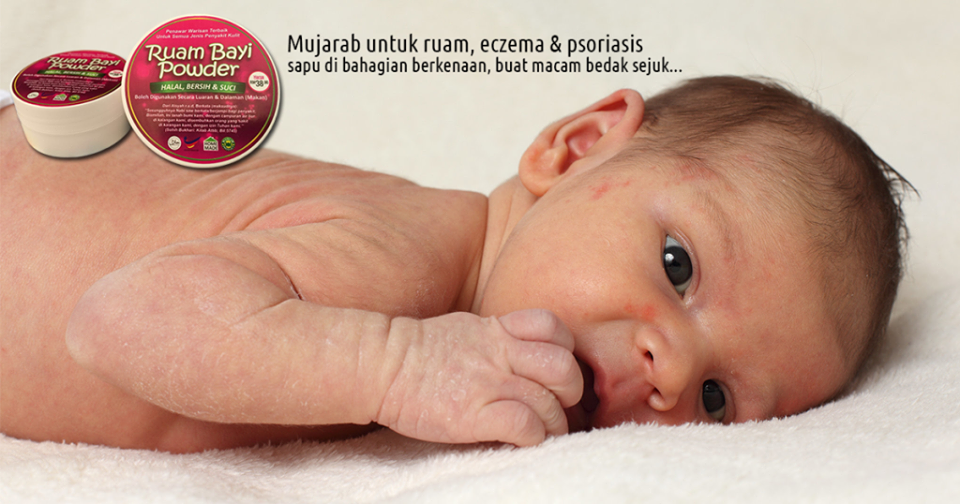 Blog Lea Azleeya: Ruam Bayi Powder Penawar Untuk Segala Jenis Penyakit ...
