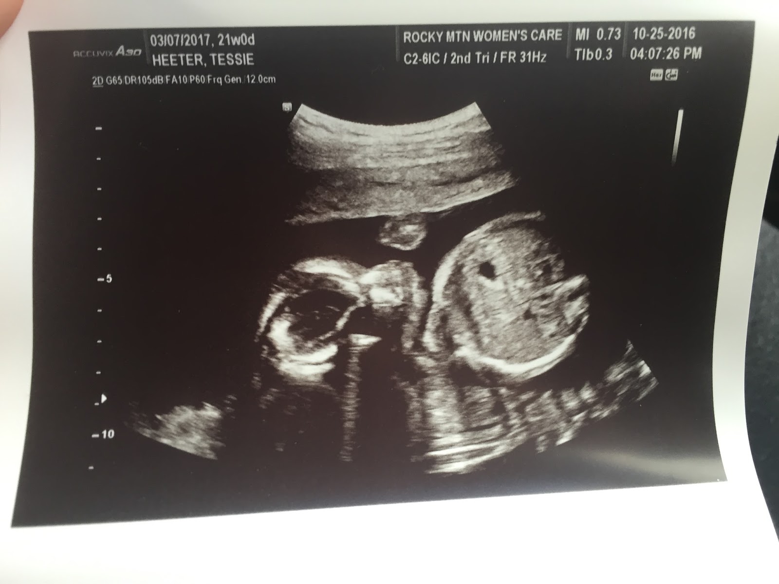 Growing a Heeter: 21 Weeks, 4 Days Pregnant!