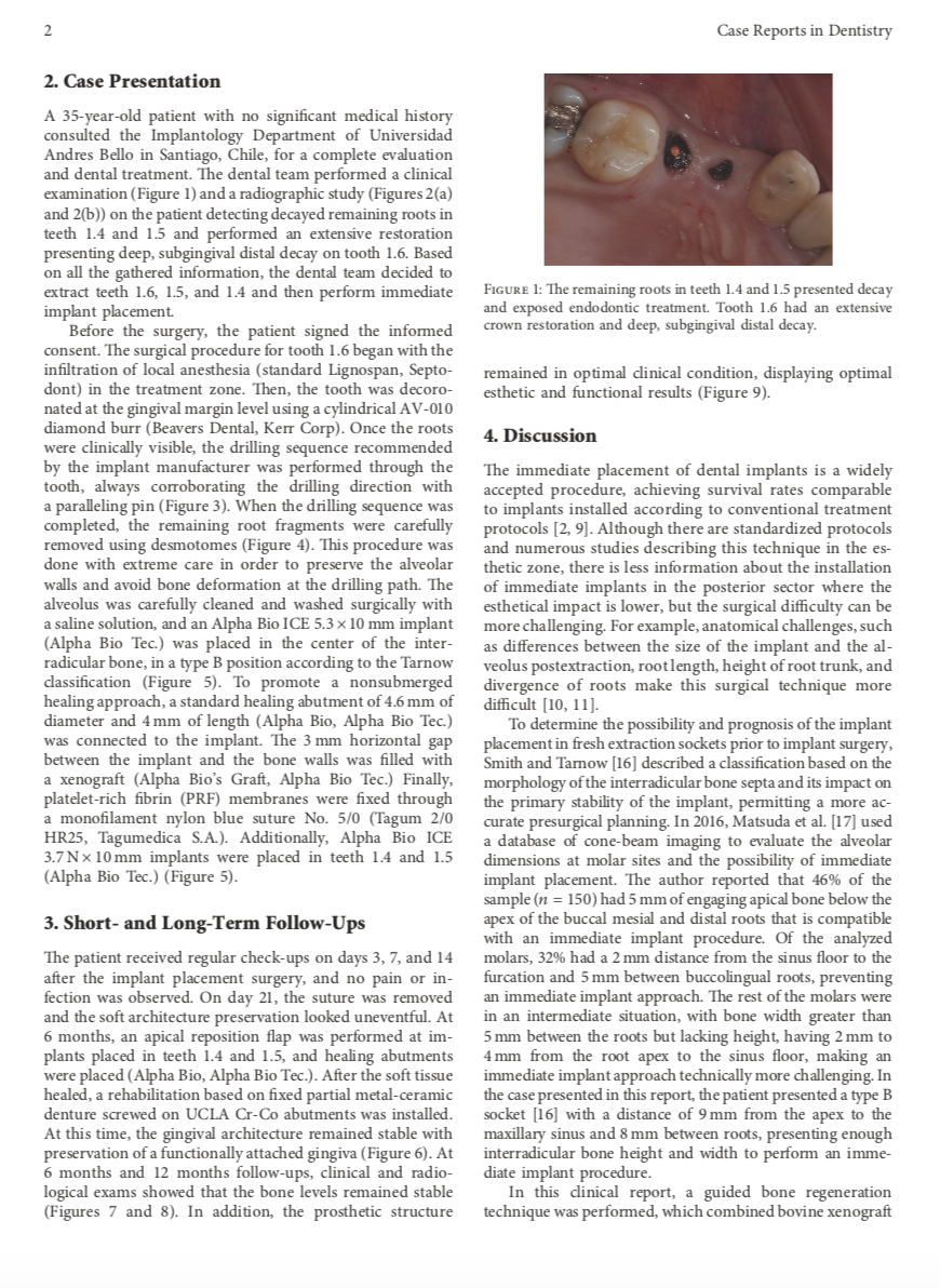 Reporte de Caso Clinico en Case Report In Dentistry