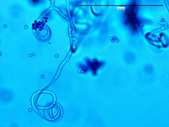 Fun With Microbiology (What's Buggin' You?): Trichophyton ...