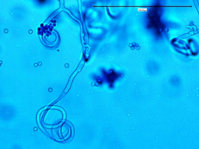 Fun With Microbiology (What's Buggin' You?): Trichophyton ...