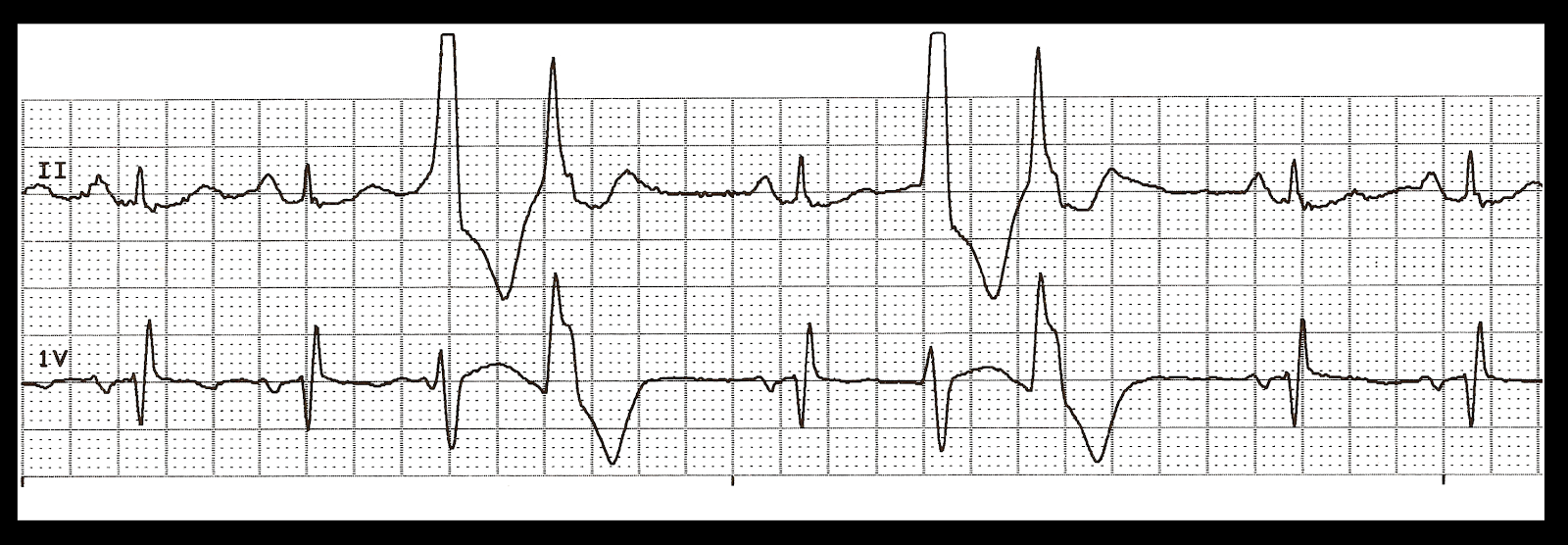 EKG Rhythm Quiz 219