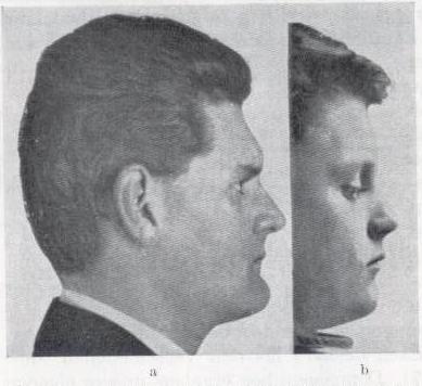 Aryan Anthropology: The Profile View