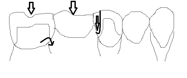 Pier (intermediate) bridge abutments