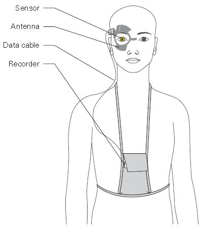 GLAUCOMA SPECIALIST BLOG: "THE GLOG"
