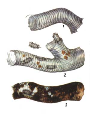 CORONA APICULTORES: ACARIOSIS