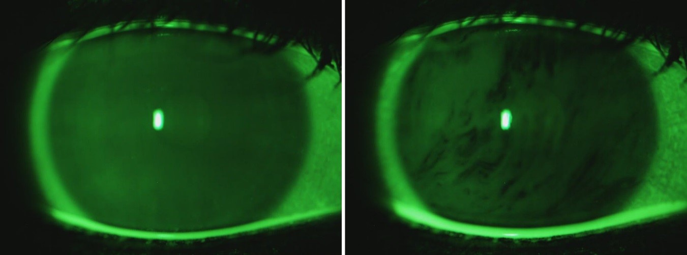 Contactología Moderna: agosto 2016