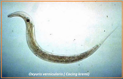 BIOLOGI GONZAGA: NEMATHELMINTHES-CACING GILIG