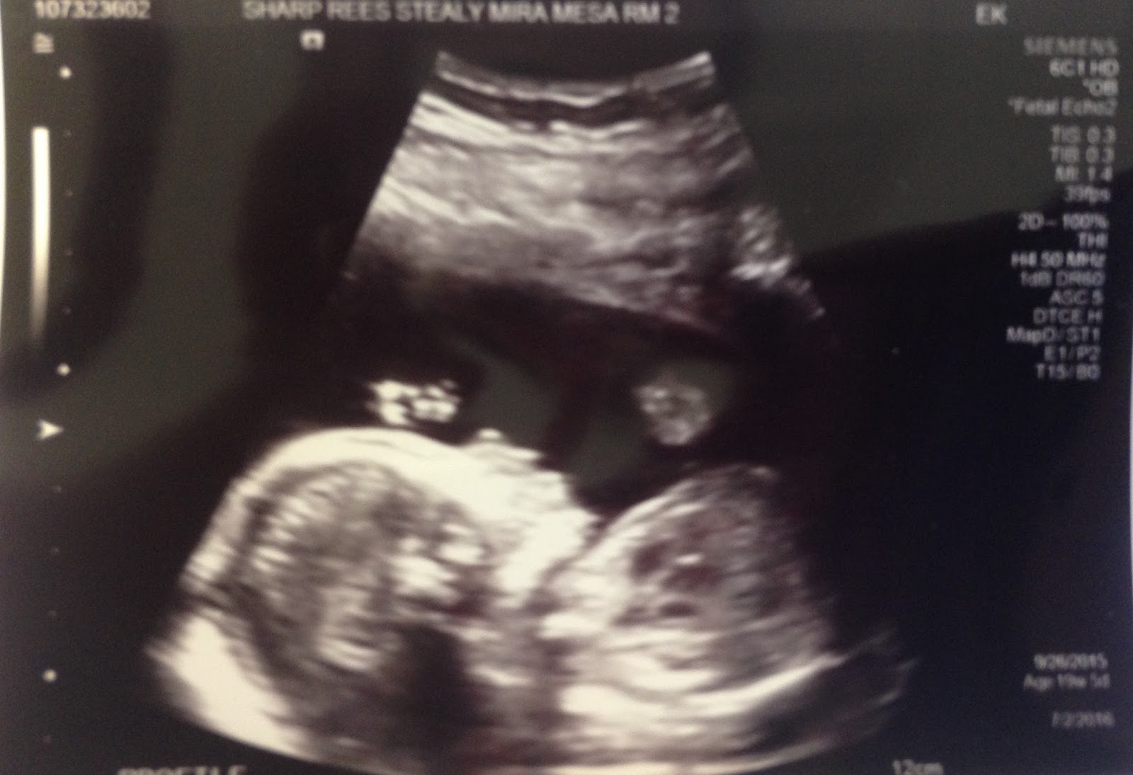 In Bloom: Pregnancy Update - 20 Weeks