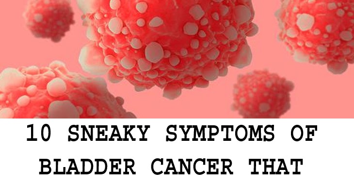 10 SNEAKY SYMPTOMS OF BLADDER CANCER THAT EVERY WOMAN NEEDS TO KNOW