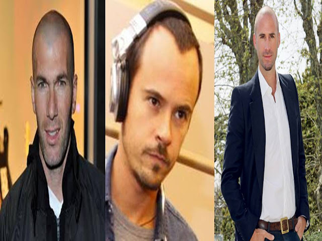 Blog Das Moraes: Dicas para os Carecas