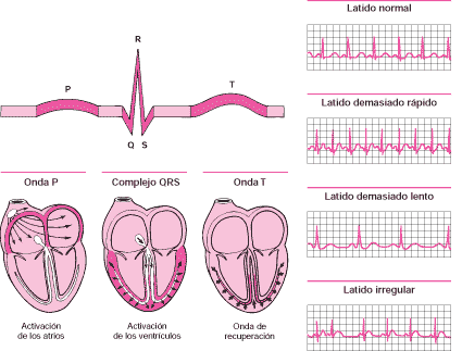 electrocardiograma