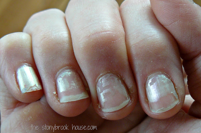 I Am Free & { Manicure Miracle} | The Stonybrook House